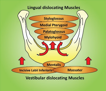 Retromylohyoid Space